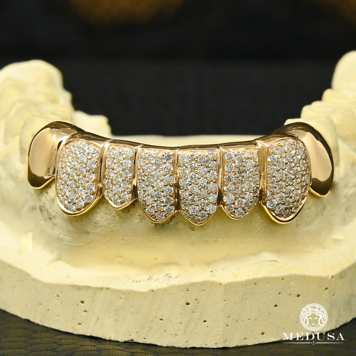 Grillz Custom en Or | Grillz 8 Dents Diamant PermaCut - Yellow Grillz ...